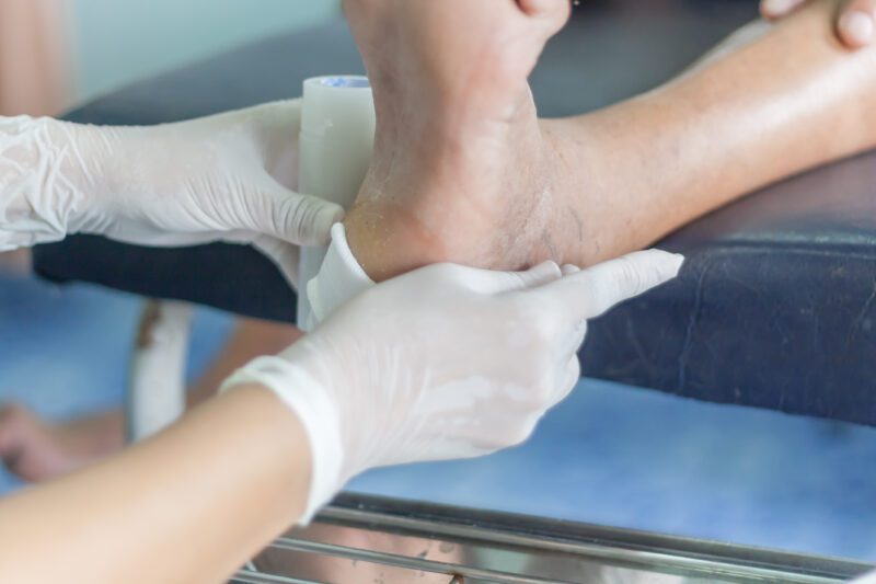 Trauma Wounds | Innovative Wound Care Specialists